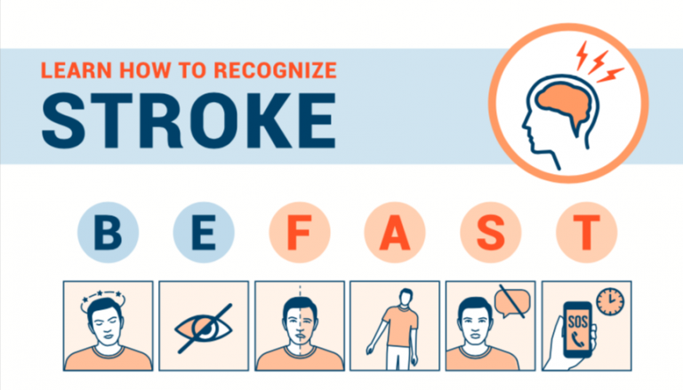 Learn How to Recognize a Stroke - Rockledge Regional Medical Center